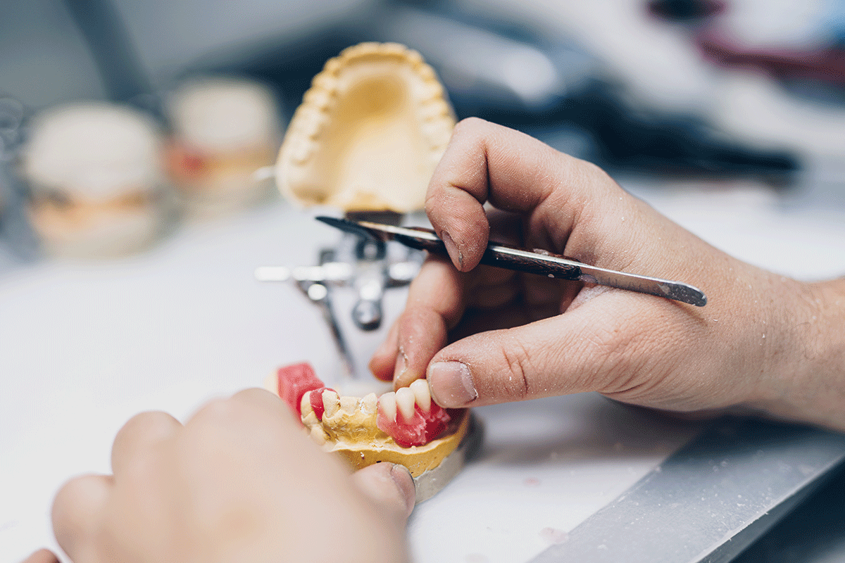 What Are All the False Teeth Options | Best Fake Teeth Options